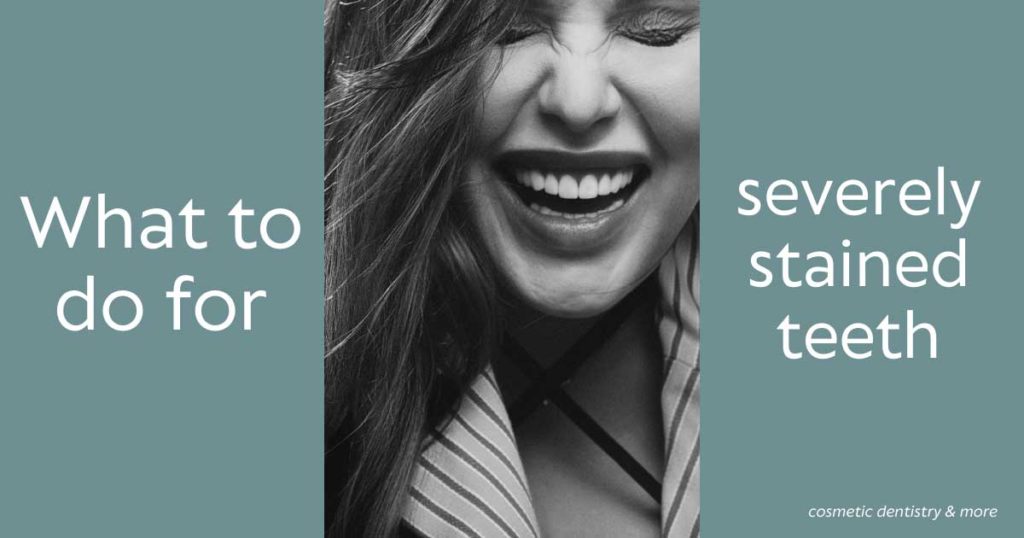 What to Do For Severely Stained Teeth - Hoffman Estates Cosmetic Dental ...